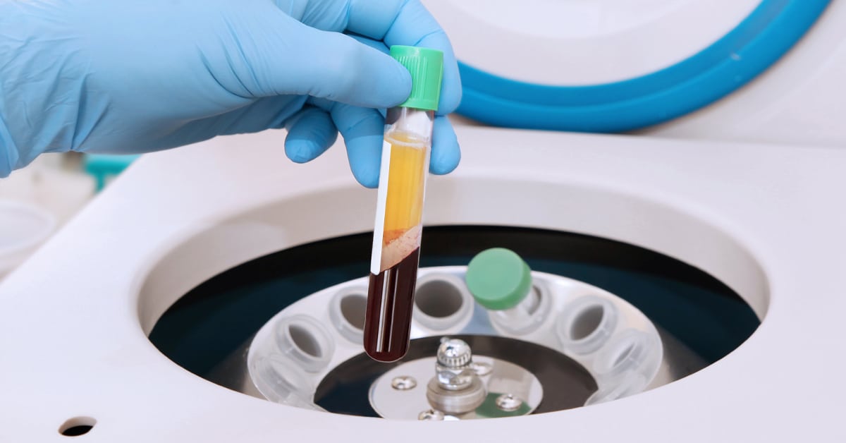 Naples Physician Details Sexual Health Benefits Of O Shot®